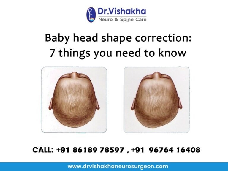 Baby’s abnormal head shapes when to worry? - Dr Vishaka Patil